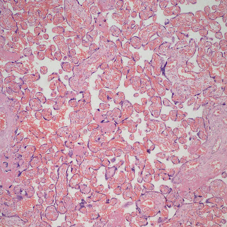 Perinatal Pathology