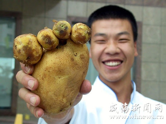 Potato That Resembles A Human Foot