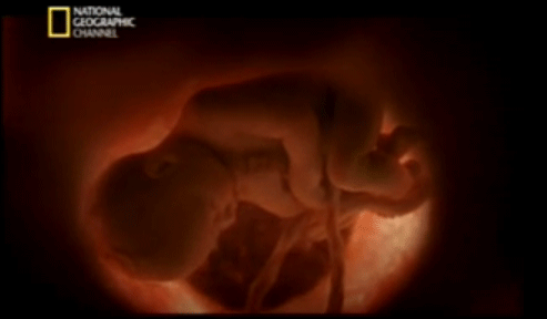 Planeta Mamá y Bebé: Embarazo: semana 37