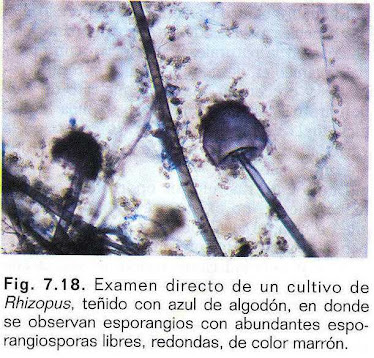 Enfermedades por hongos