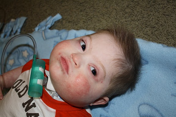 Jaxsons Fight: Jaxsons Story