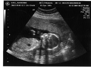 new: Our 18 week Ultrasound Pictures