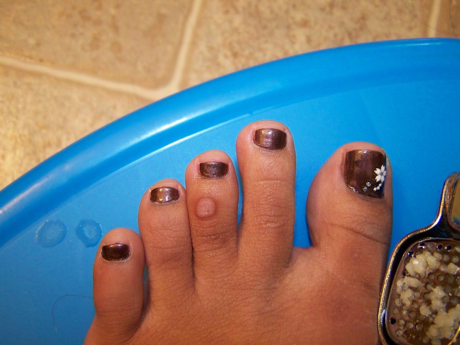 Huntington Legacy Header: Toes, Teeth and Pigtails