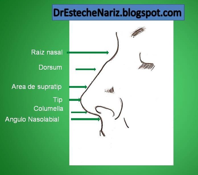Dr Esteche | Rinoplastia | Cirugía | Plástica de Nariz | Nose |Surgery ...