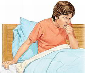 Virus y Bacterias: Tos Ferina o tos convulsiva