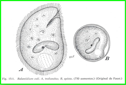 Parasitology World: BALANTIDIUM COLI