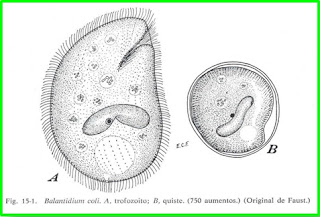 Parasitology World: BALANTIDIUM COLI