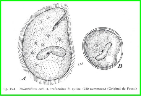 Parasitology World: BALANTIDIUM COLI