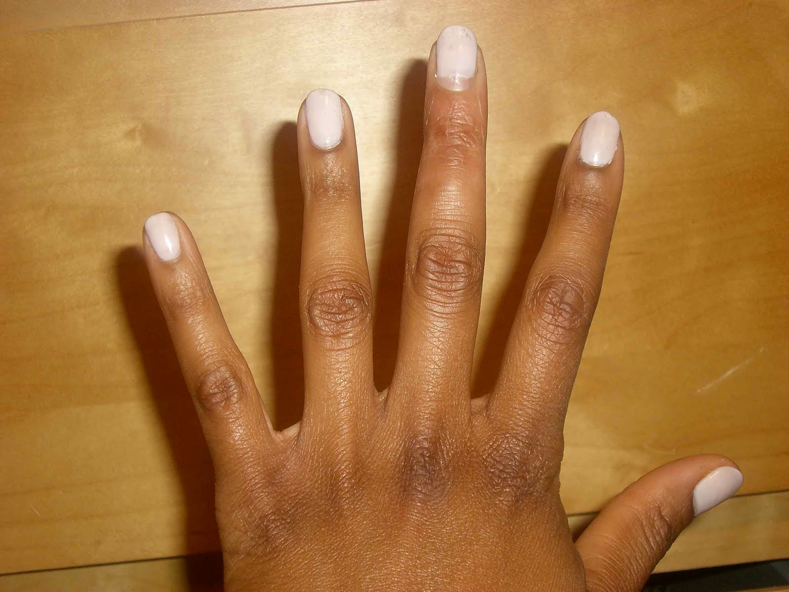 Master of Occupational Therapy - My Student Blog: Update on my Mallet ...