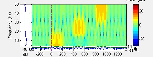 Bishop_techbits: Simplified introduction to time-frequency analysis in ...