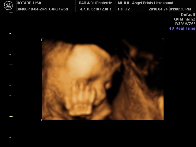 You Could Always Adopt. . .: Baby girl - 27 week 4d ultrasound