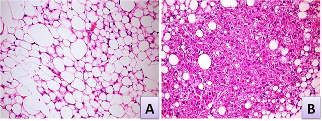 SOS BIOLOGIA CELULAR Y TISULAR: TEJIDOS. ADIPOSO