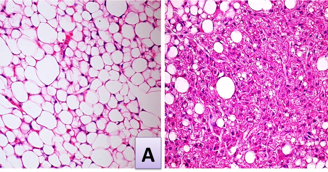 SOS BIOLOGIA CELULAR Y TISULAR: TEJIDOS. ADIPOSO