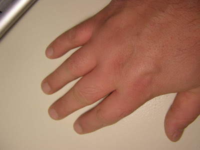 Scandihams: University edition : r/fatpeoplestories