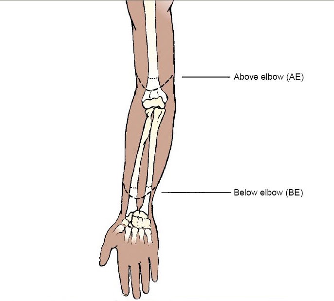 Nursing Care Plans For Amputation