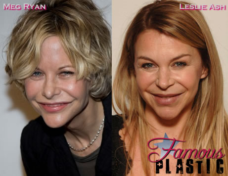 aryanex blog: 11/26/10