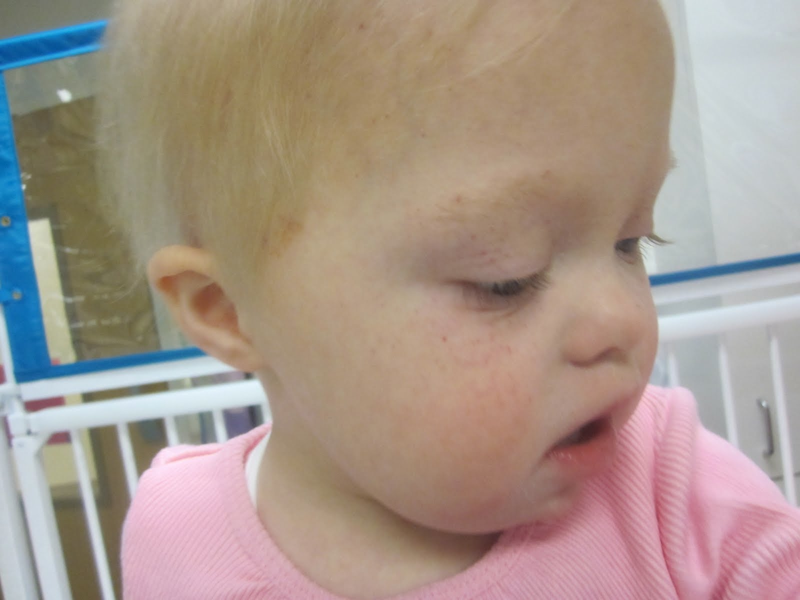 Sweet Ella Grace: Petechiae