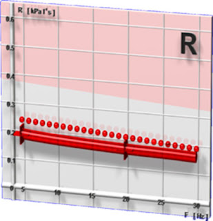 IOS Impulse Spirometry- quick, quiet, and cooperation free.