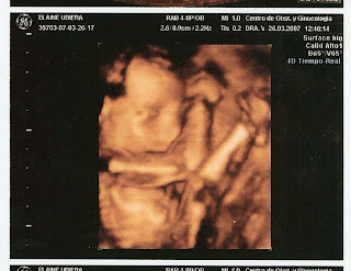 BabyUbiera: 4D ultrasound - 22 weeks - Yawning!!!