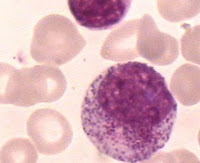 inmuno-hematologia: SISTEMA INMUNITARIO