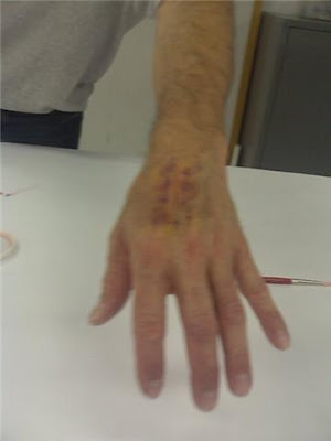 Awkward Creations: Kit Day - Paint-On Scars, Bruises, and Burns