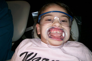 A Day In The Life Of...: Brace-Face