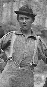 Everything About Braces: History of Braces