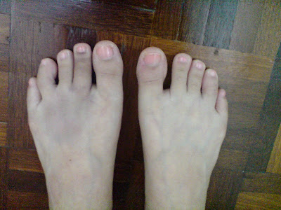 Little RAINBOW: Twisted Toe