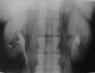 Radiology Technology: Linear Tomography