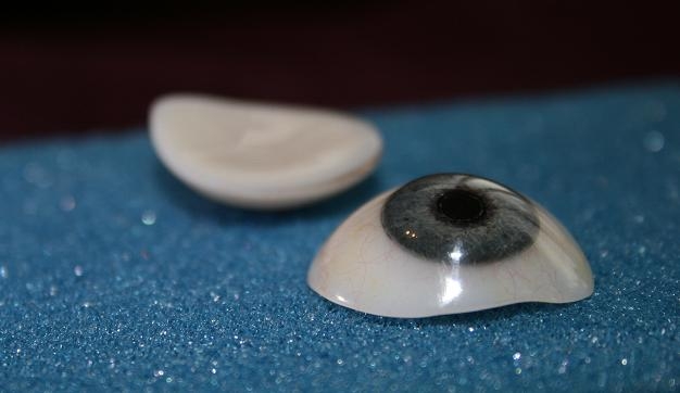 Eye Optix: Synthetic Eye Prosthesis