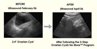 Holistic Medicine and Holistic Healing: The Possible Negative ...