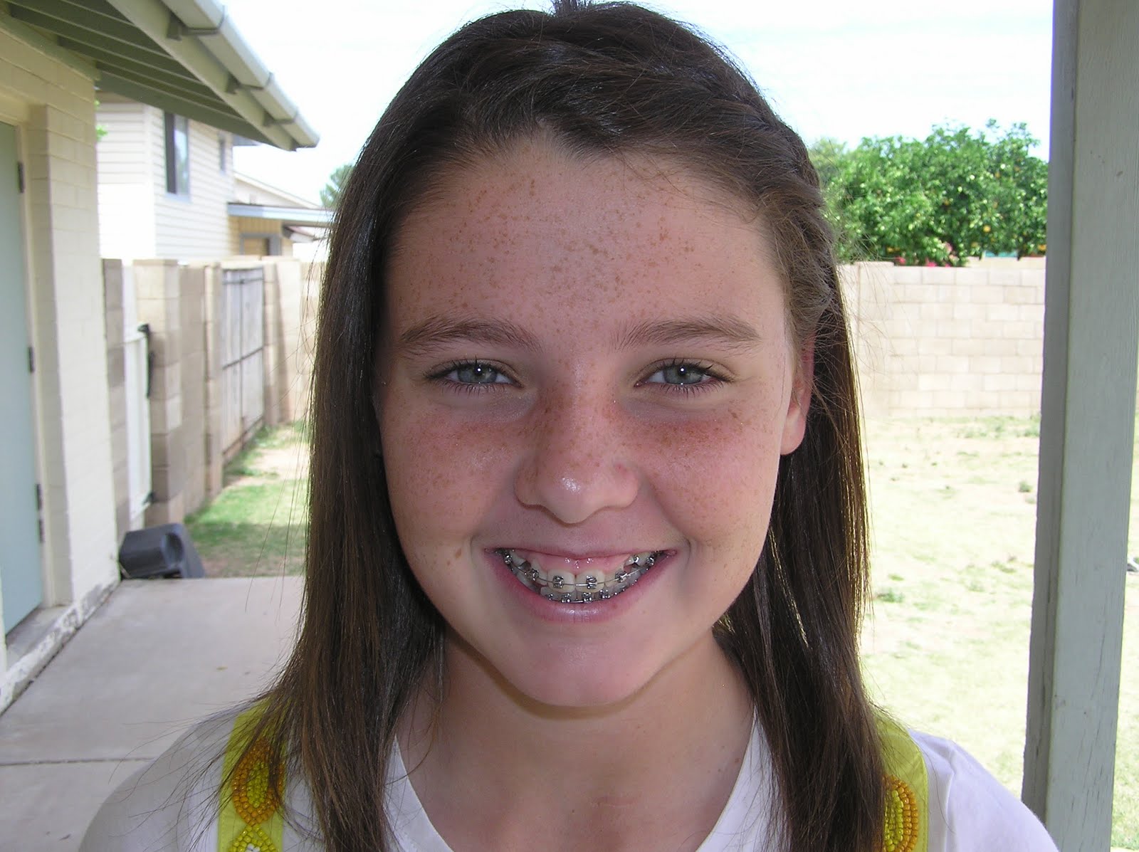 The HannaFamily: Haley's Braces