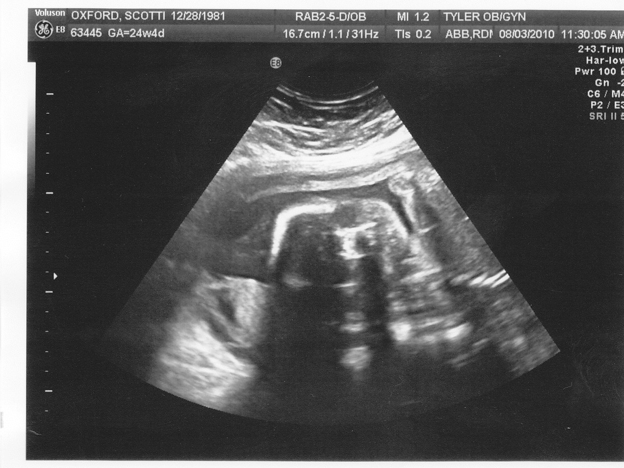 The Oxford Family: 26 weeks pregnant and baby O pictures