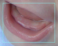 Otročarije - blog: Prvi mlečni zobki