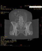 SCANNER LIGHT SPEED PRO 32