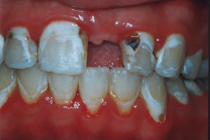 Brain Rage: Your Teeth Evince Your Class Status