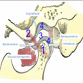 Ortodoncia y ATM: Dolor por disfunción de la ATM