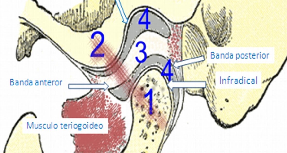 Ortodoncia y ATM: Dolor por disfunción de la ATM