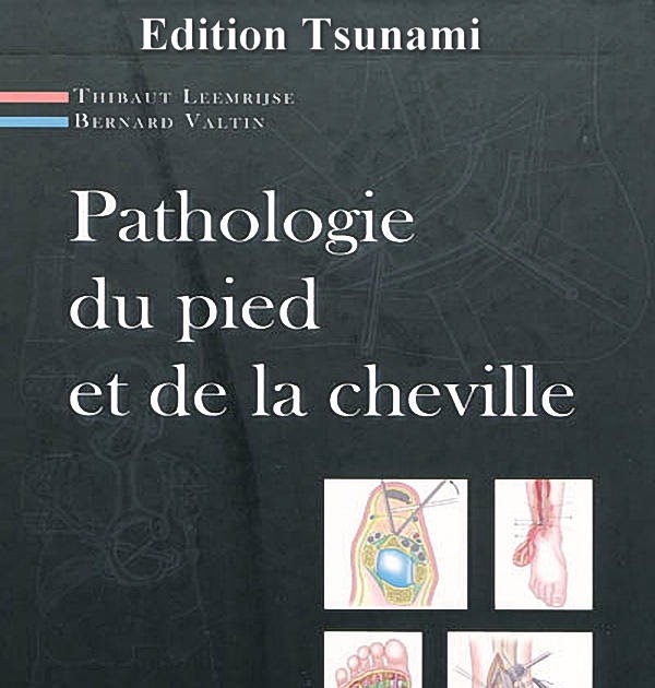 Pathologie du pied - pervi58vamack