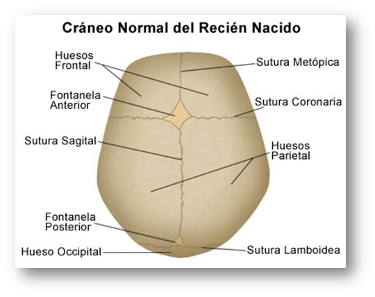 Craneosinostosis: Craneosinostosis