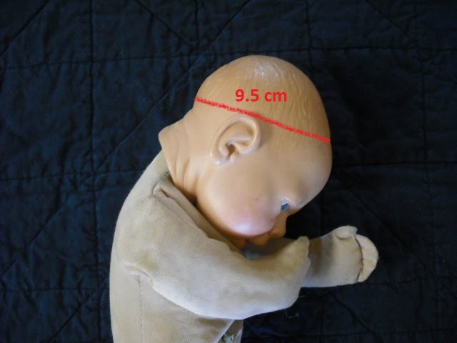 Natural Birth In Kitsap: Optimal Fetal Positioning, Part 2 - The Fetal Head