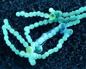 NaturalHome: CIANOBACTERIAS