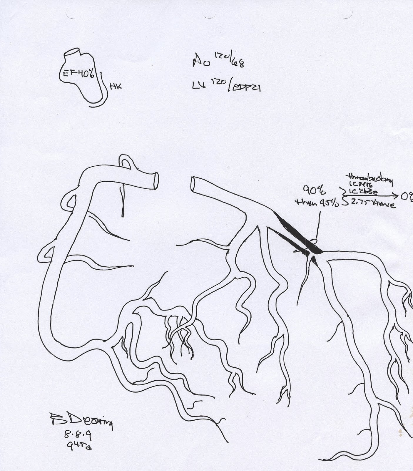 Heartsick and Headstrong: The Widowmaker. This is what a heart attack ...