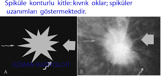 MAMOGRAFİK VE SONOGRAFİK BI-RADS KATEGORİLERİ-I