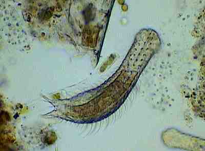Phylum Gastrotricha