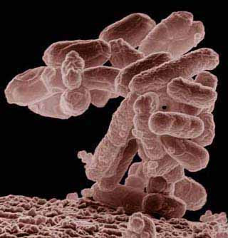 E.coli and bloody diarrhea