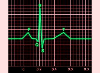 KURSUS EKG (Elektrokardiografi) Bagian I: I. EKG