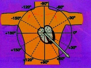 KURSUS EKG Bagian II: II.4. Aksis Jantung