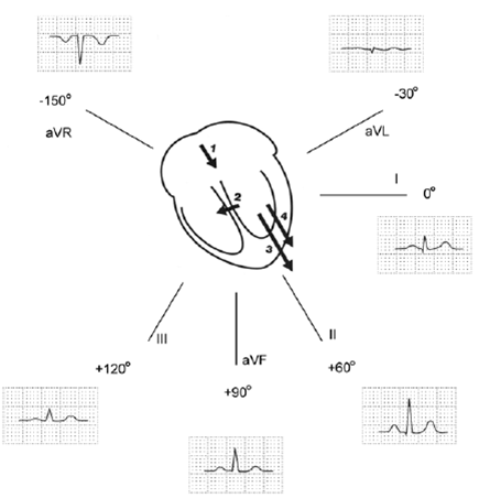 KURSUS EKG Bagian III: III.2. Normal EKG