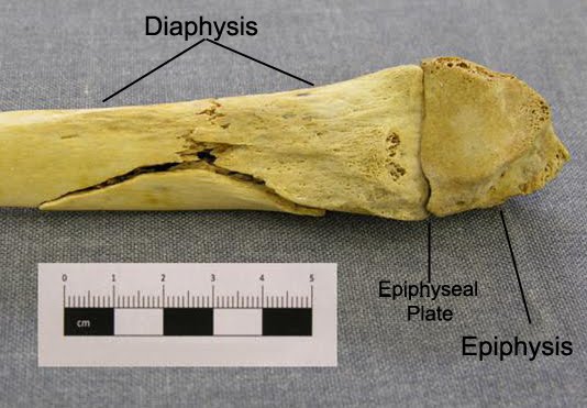 Flesh and Bones: AGE ESTIMATION FROM VERTEBRAL EPIPHYSES